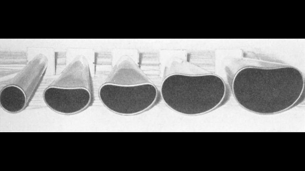 Siemens Healthineers history in mammography