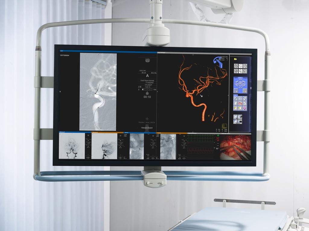 Angiographie – Siemens Healthineers Deutschland