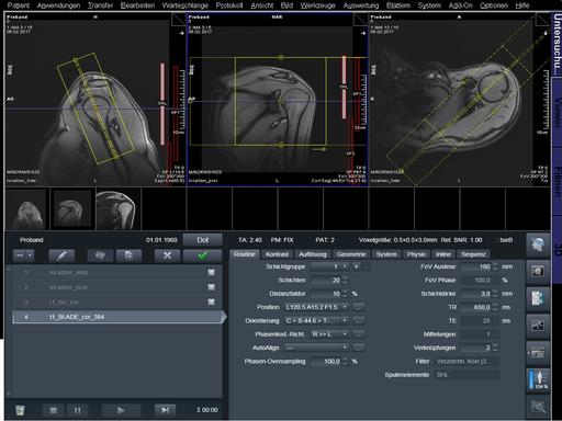 Magnetic Resonance Imaging (MRI) - MAGNETOM® MRI Scanner - Siemens ...