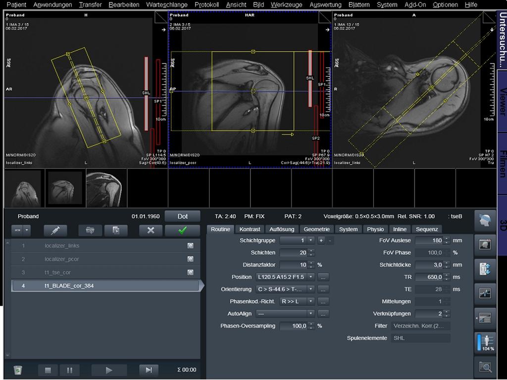 Tim - Siemens Healthineers USA