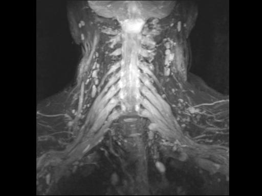 Neurology / Neurography