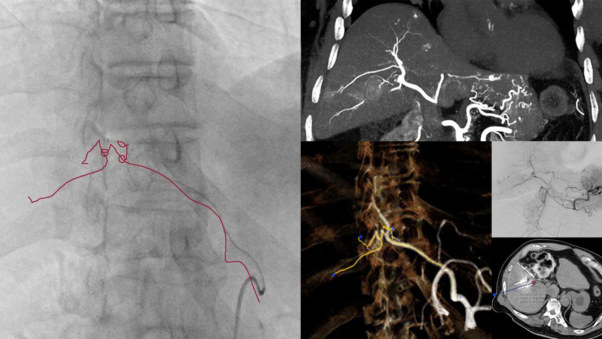 Nexaris Angio-CT - Siemens Healthineers USA