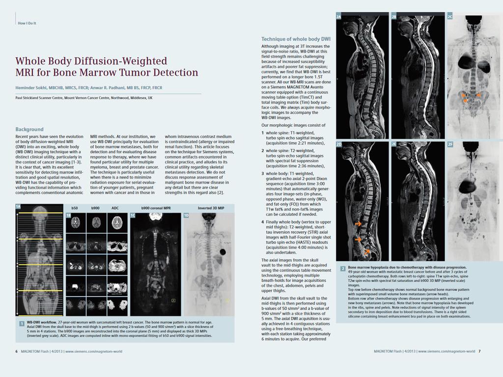 Quantitative Whole-Body MRI - Siemens Healthineers USA