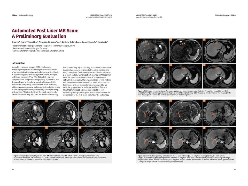 A time-optimized workflow for Primovist® liver MRI