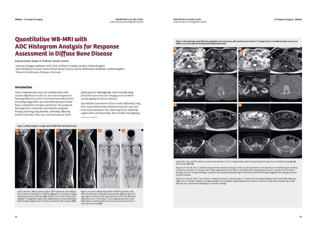 Quantitative Whole-Body MRI - Siemens Healthineers USA