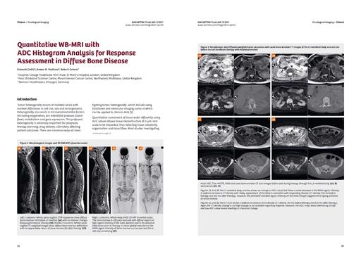 Quantitative Whole-Body MRI
