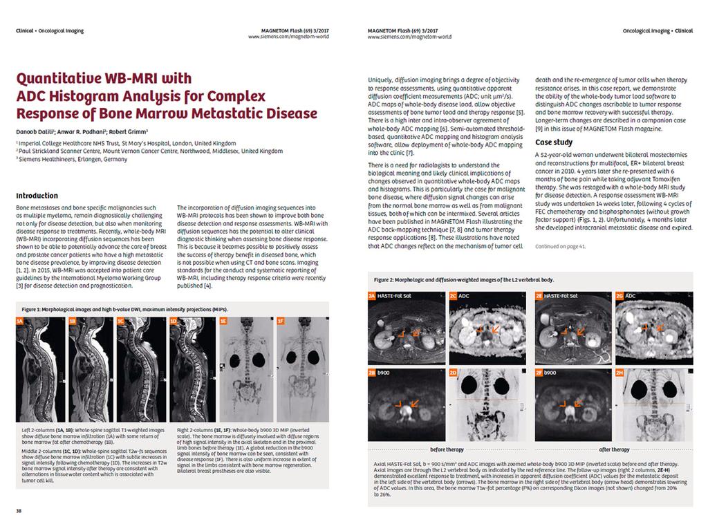 Quantitative Whole-Body MRI
