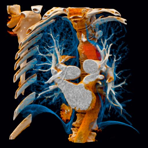 SOMATOM go.Top - Siemens Healthineers Vietnam