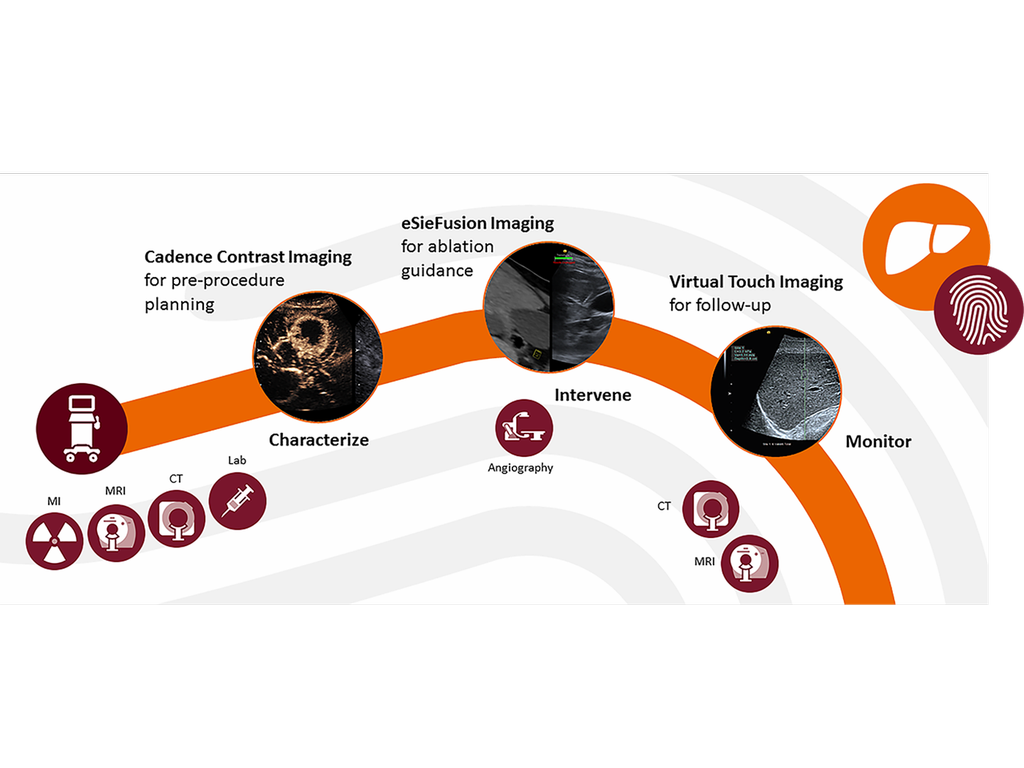 Delivering Precision Medicine Through Personalized Ultrasound Siemens ...