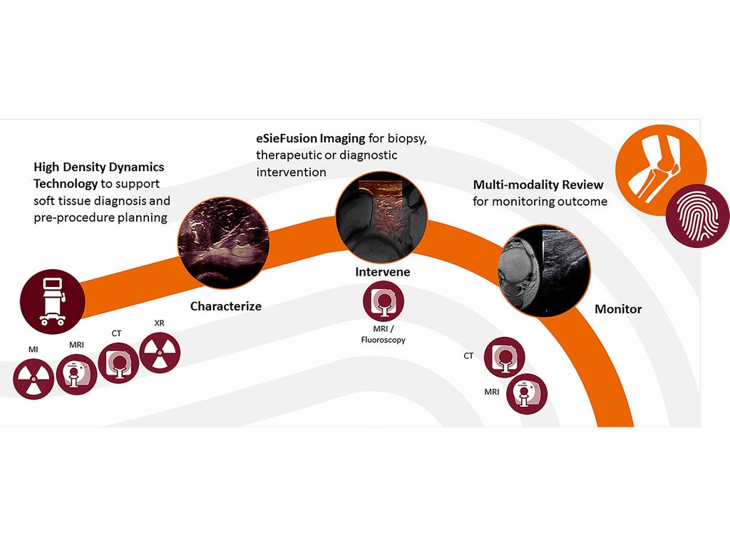 Delivering Precision Medicine Through Personalized Ultrasound Siemens ...