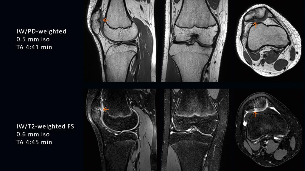 GOKnee3D - Siemens Healthineers USA