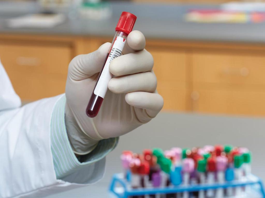 HIV Test Solutions - Siemens Healthineers - Siemens Healthineers