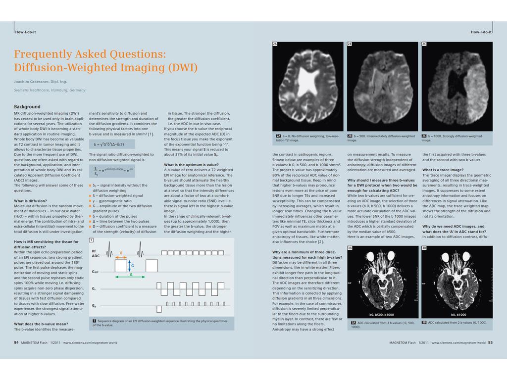 Slice Order (Slice Timing) for fMRI Evaluation