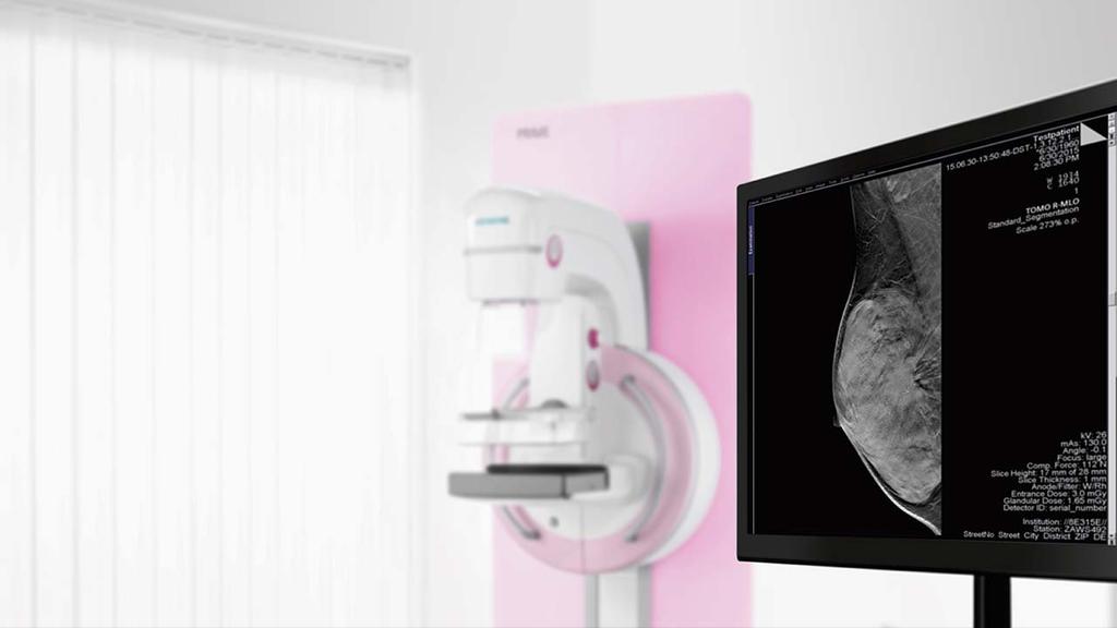 History of mammography: 2003 – 2016 - Siemens Healthineers