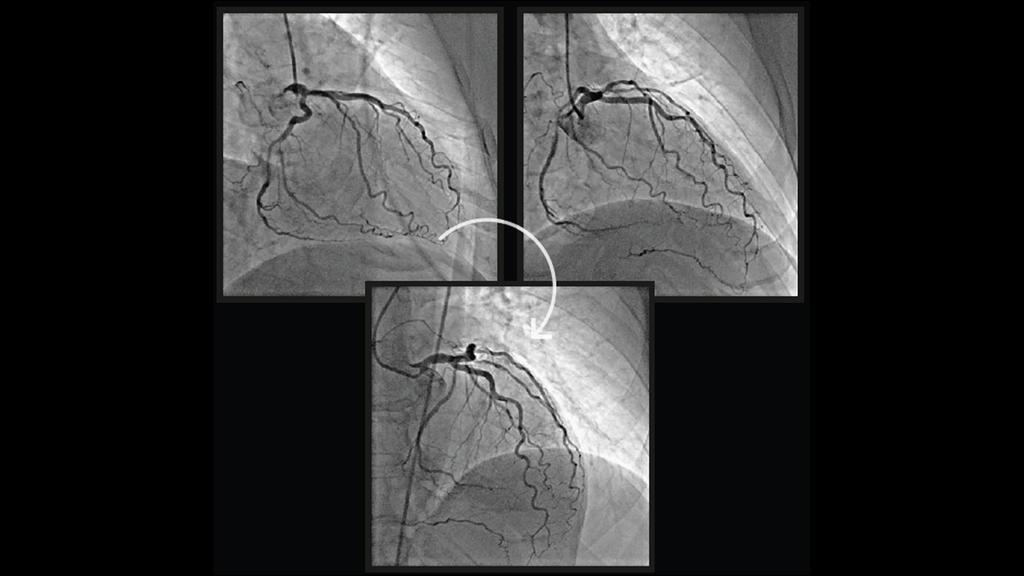 Cardiac Solutions - Siemens Healthineers USA