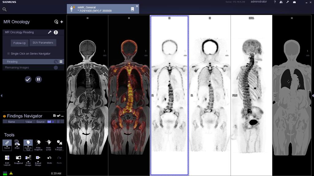syngo.via for MRI - Siemens Healthineers