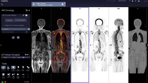 syngo.via for MRI - Siemens Healthineers