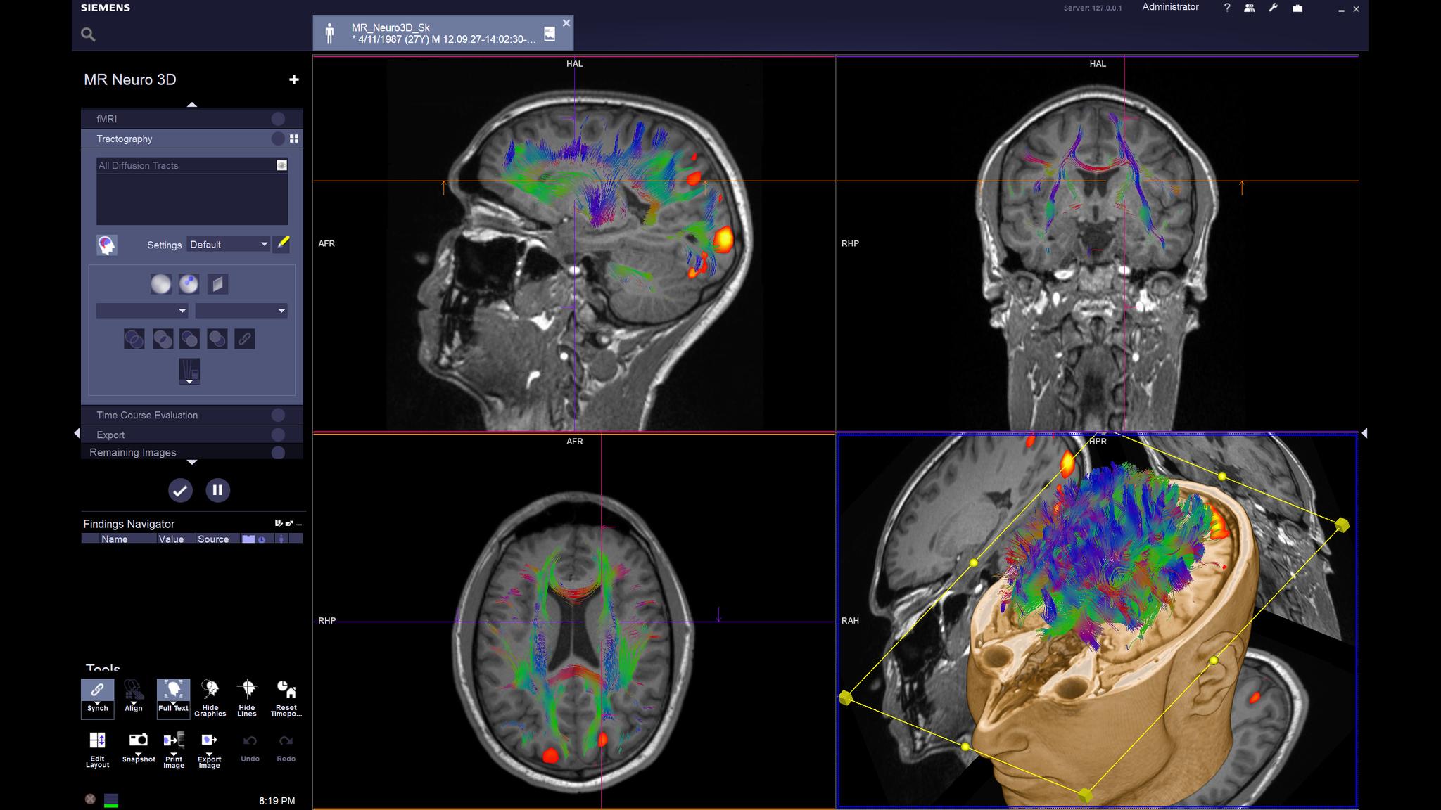 syngo.via for MRI - Siemens Healthineers