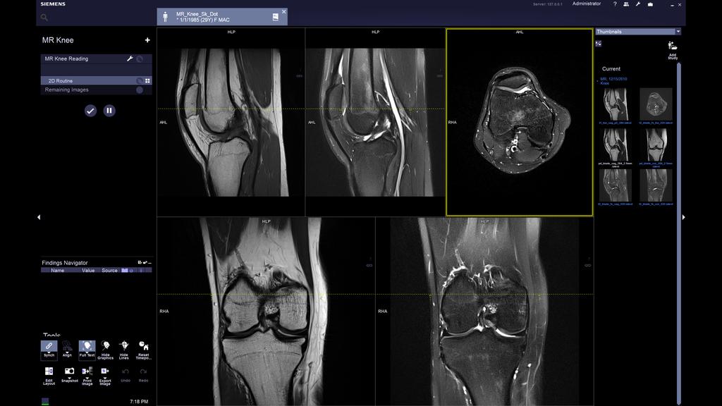 syngo.via for MRI - Siemens Healthineers