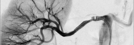 Albumin-to-Creatinine Ratio (ACR) Urine Testing - Siemens Healthineers USA