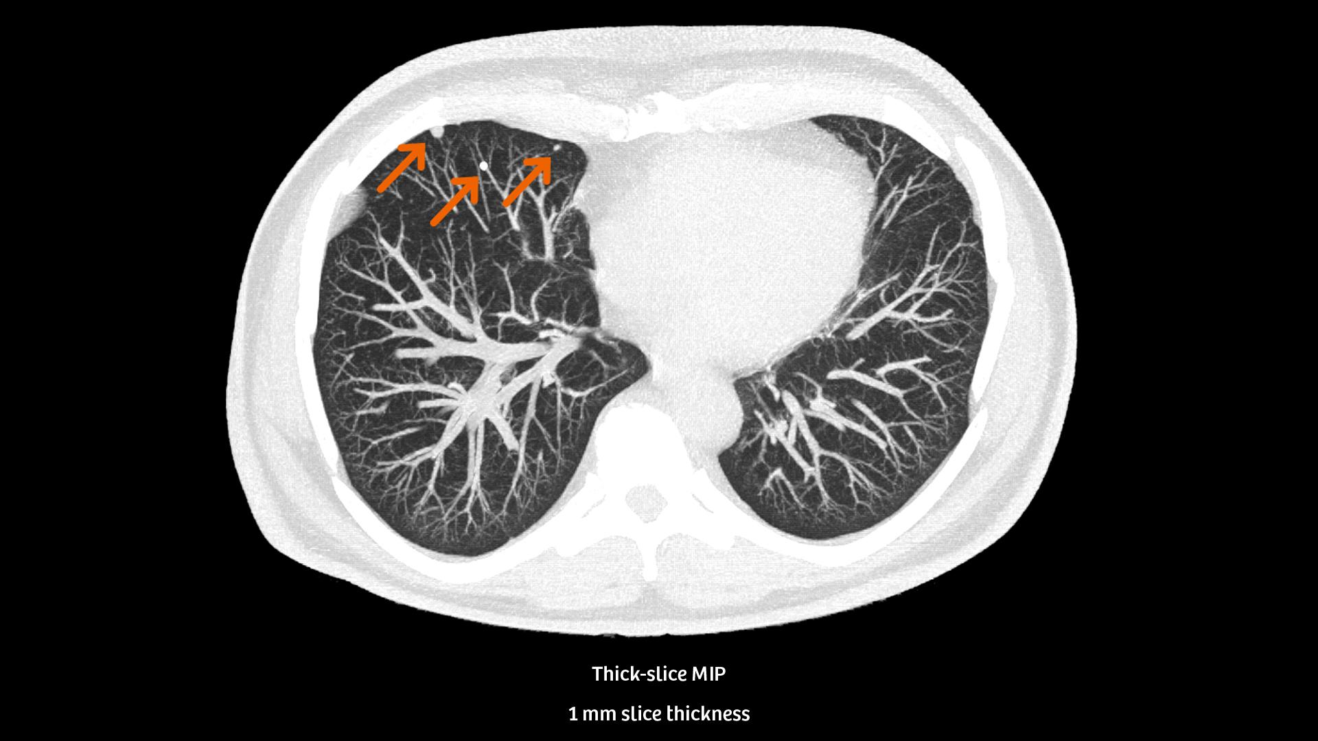 SOMATOM go.Up - Siemens Healthineers España