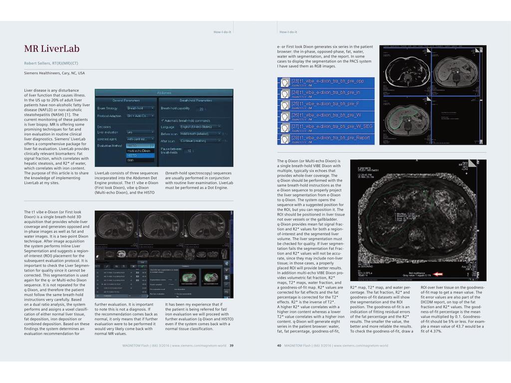 A time-optimized workflow for Primovist® liver MRI