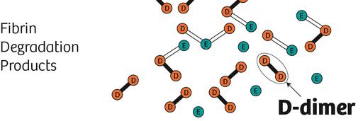 D-dimer - Siemens Healthineers USA