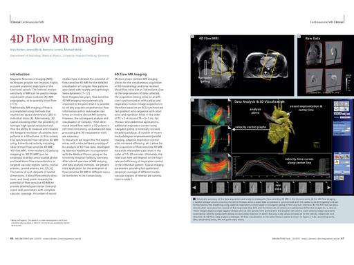 4D Flow MR Imaging
