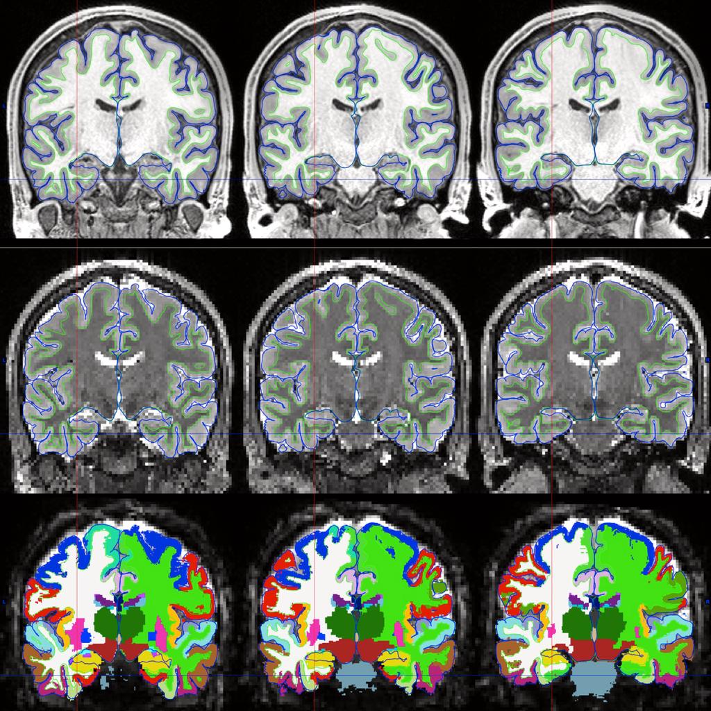 Brain Imaging Research at New York University Abu Dhabi, UAE