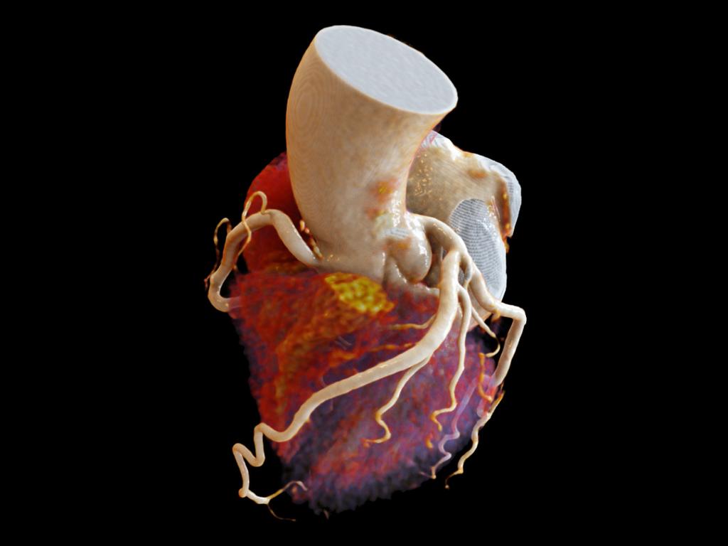 Computed Tomography - Siemens Healthineers