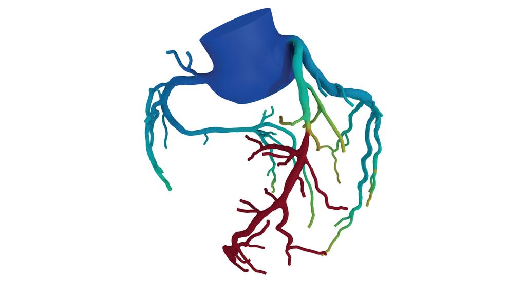 CT Cardiovascular imaging - Siemens Healthineers