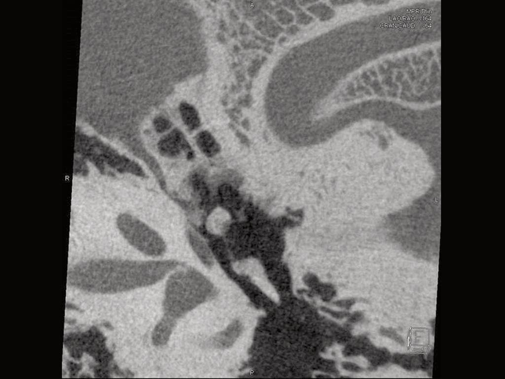 Neuroradiology - Siemens Healthineers Vietnam