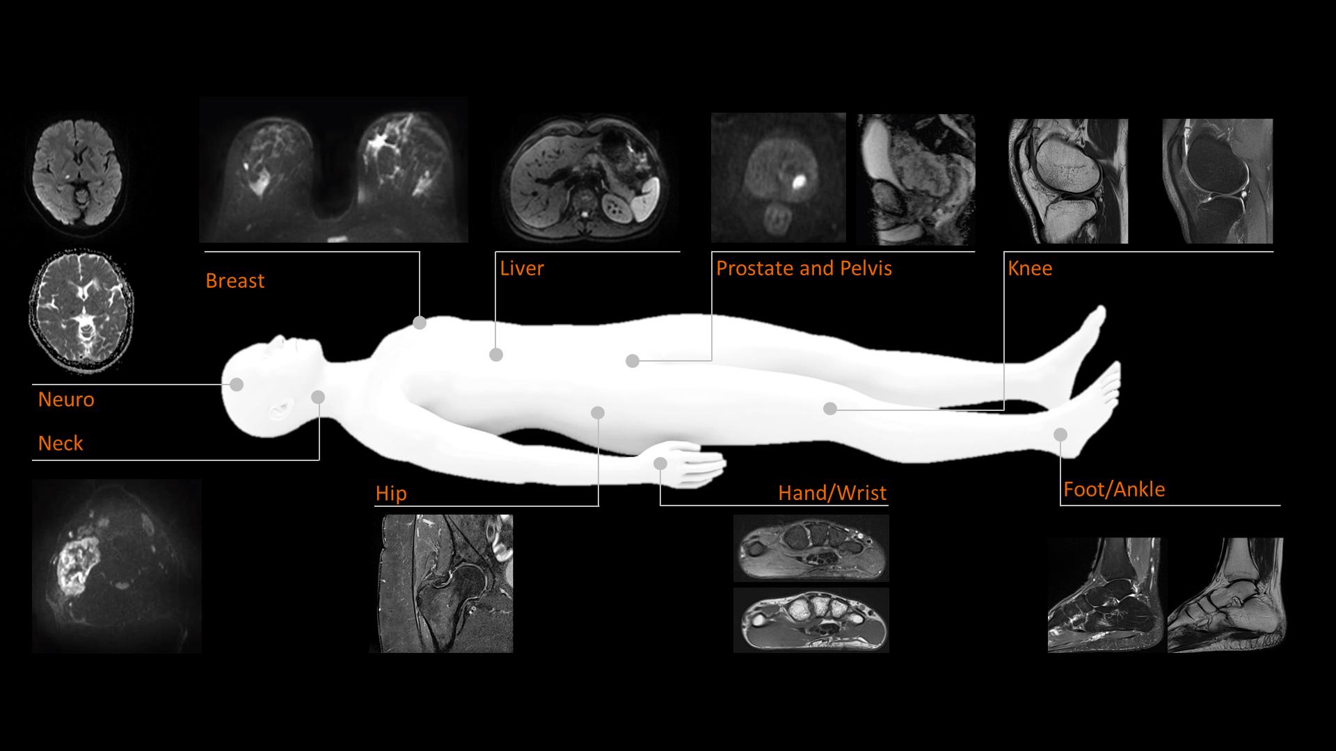 Simultaneous Multi-Slice - Siemens Healthineers