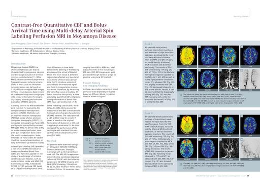 Arterial Spin Labeling