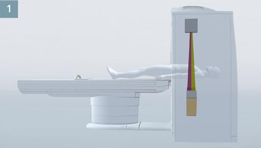 TwinBeam Dual Energy: New Benchmark in Single Source Dual Energy