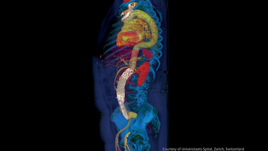 Leading Concept in High-End CT Imaging - Siemens Healthineers USA