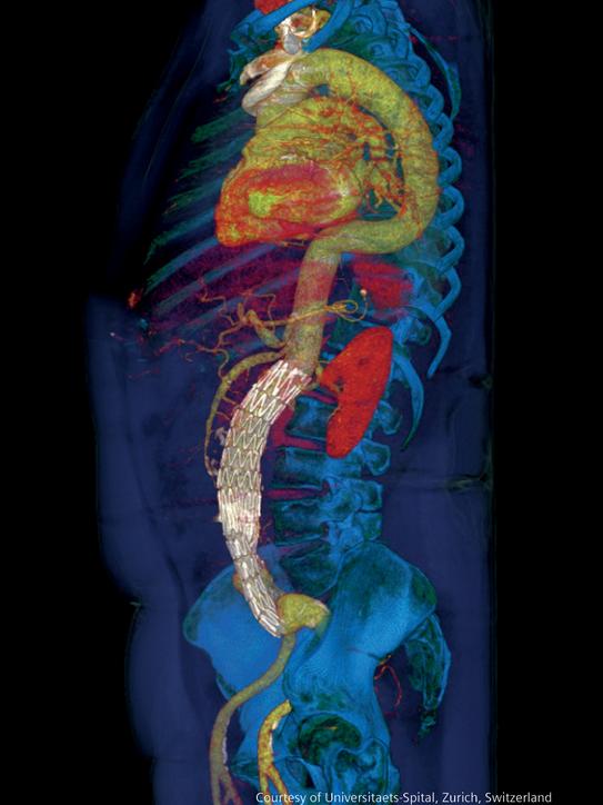 Leading Concept in High-End CT Imaging - Siemens Healthineers USA