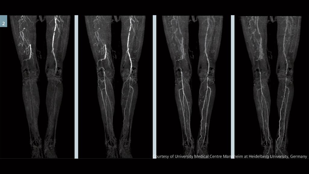 Leading Concept in High-End CT Imaging - Siemens Healthineers