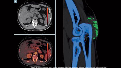 Back to the Future: 10 Years of Dual Source CT - Siemens Healthineers USA