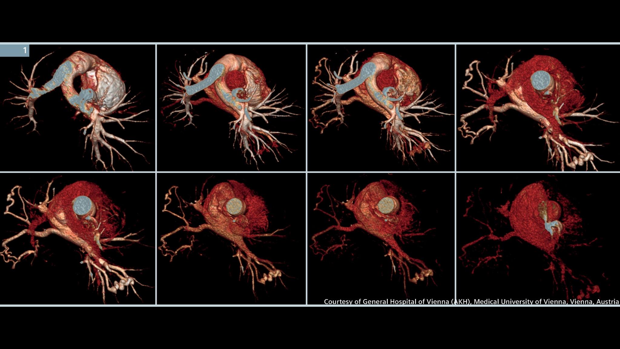 Extending the Range of Diagnostic Possibilities - Siemens Healthineers USA