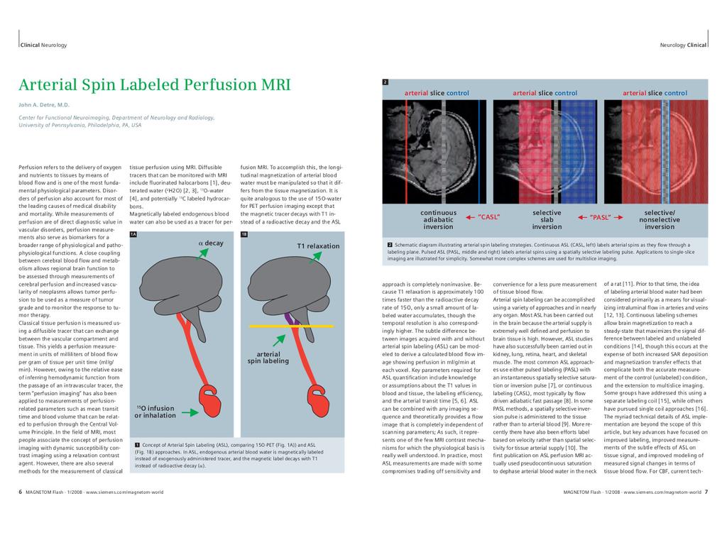 Arterial Spin Labeling