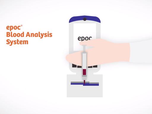 Improving the Patient Experience with Point-of-care Testing at ...