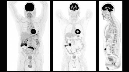Biograph Vision™ - Siemens Healthineers France
