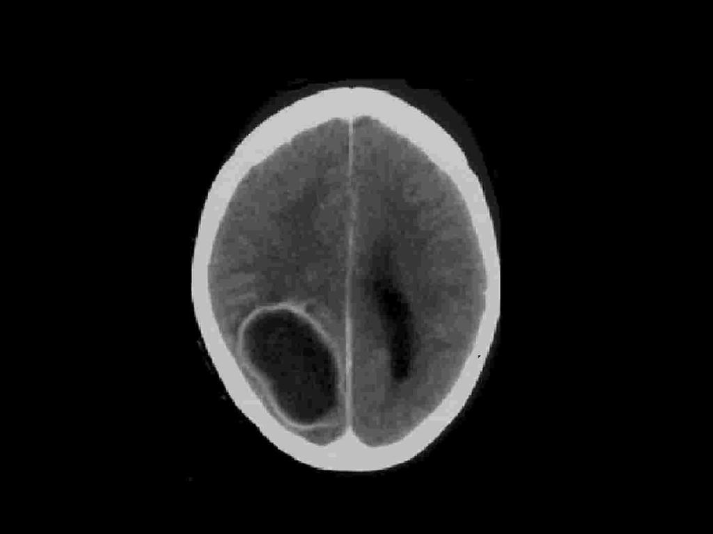 Computed Tomography Siemens Healthineers Nederland