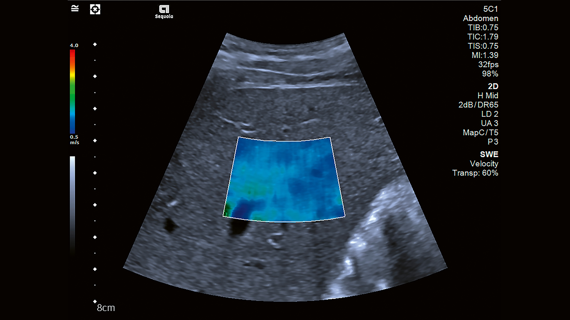 Radiology & Women’s Health - Siemens Healthineers