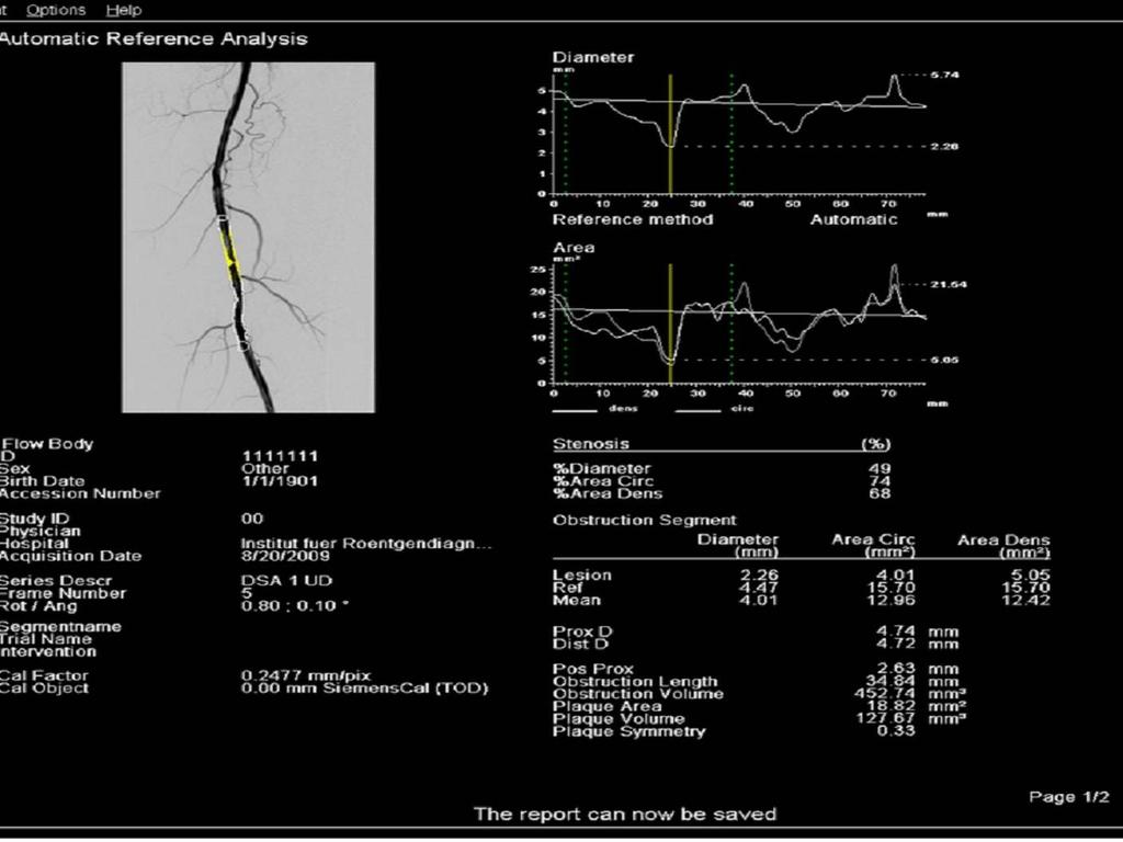 Angiography Siemens Healthineers Nederland