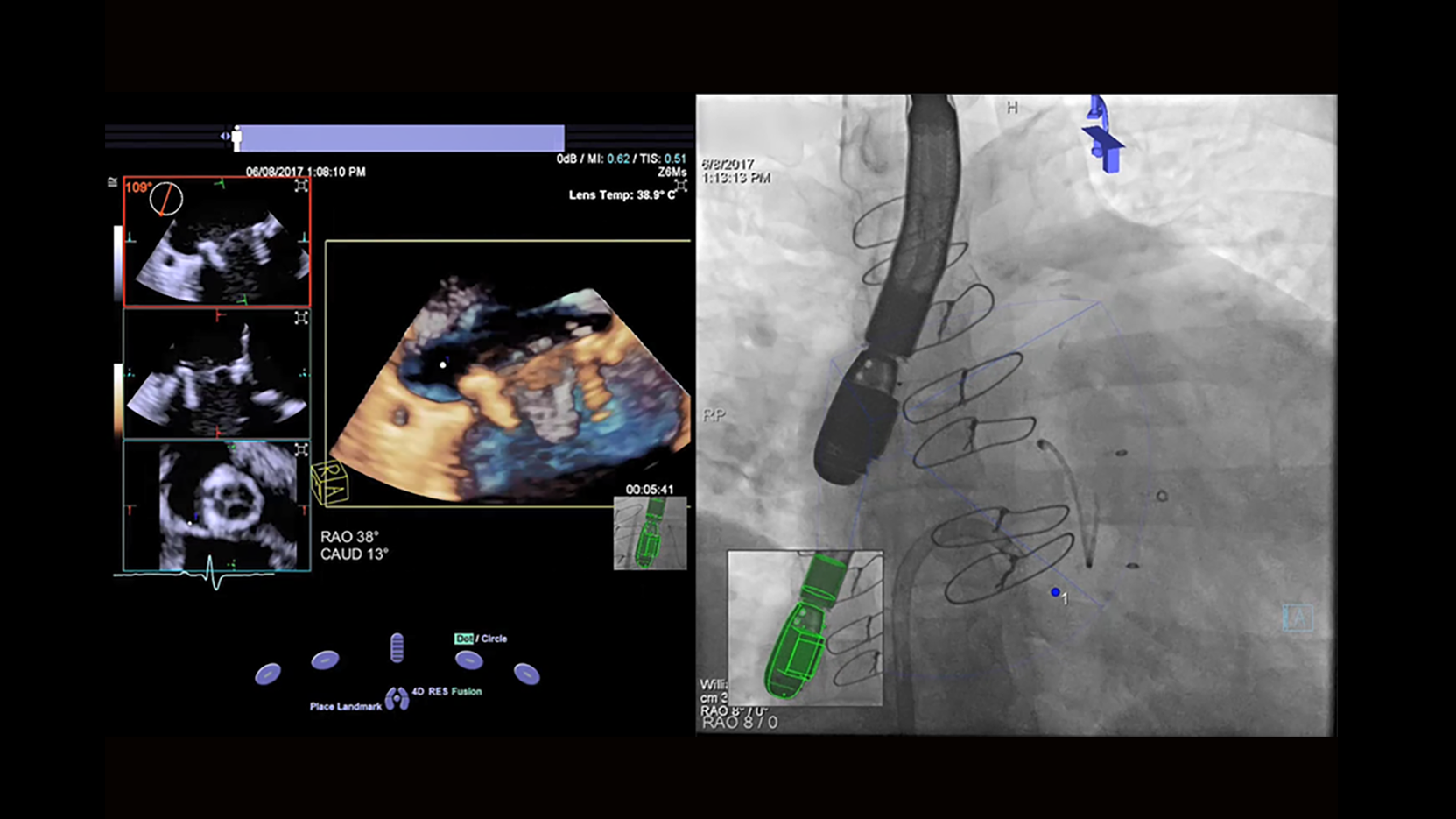 Cardiology - Siemens Healthineers