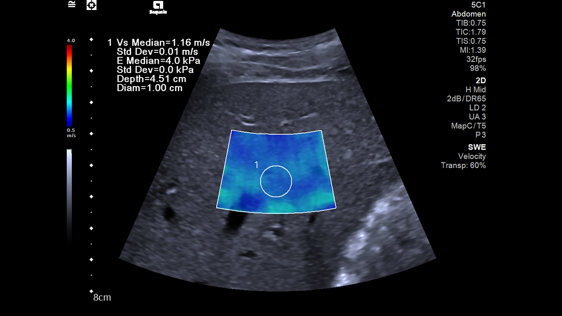 Personalized Ultrasound Solutions - Siemens Healthineers