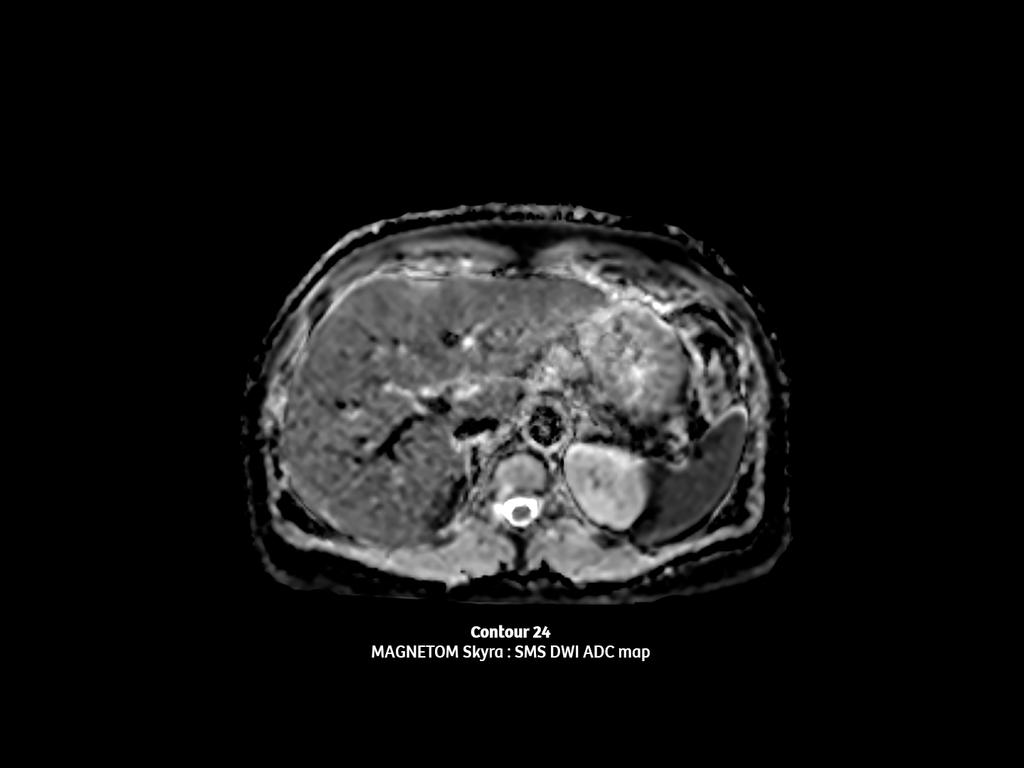 Contour - Siemens Healthineers USA