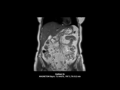 Contour - Siemens Healthineers USA